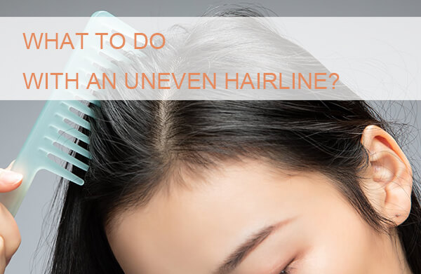 What To Do With An Uneven Hairline? | Geeshair